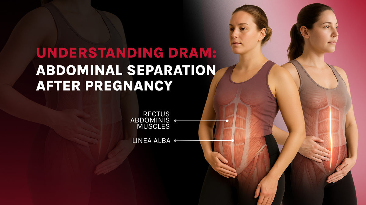 Understanding DRAM: Abdominal Separation After Pregnancy – Supacore